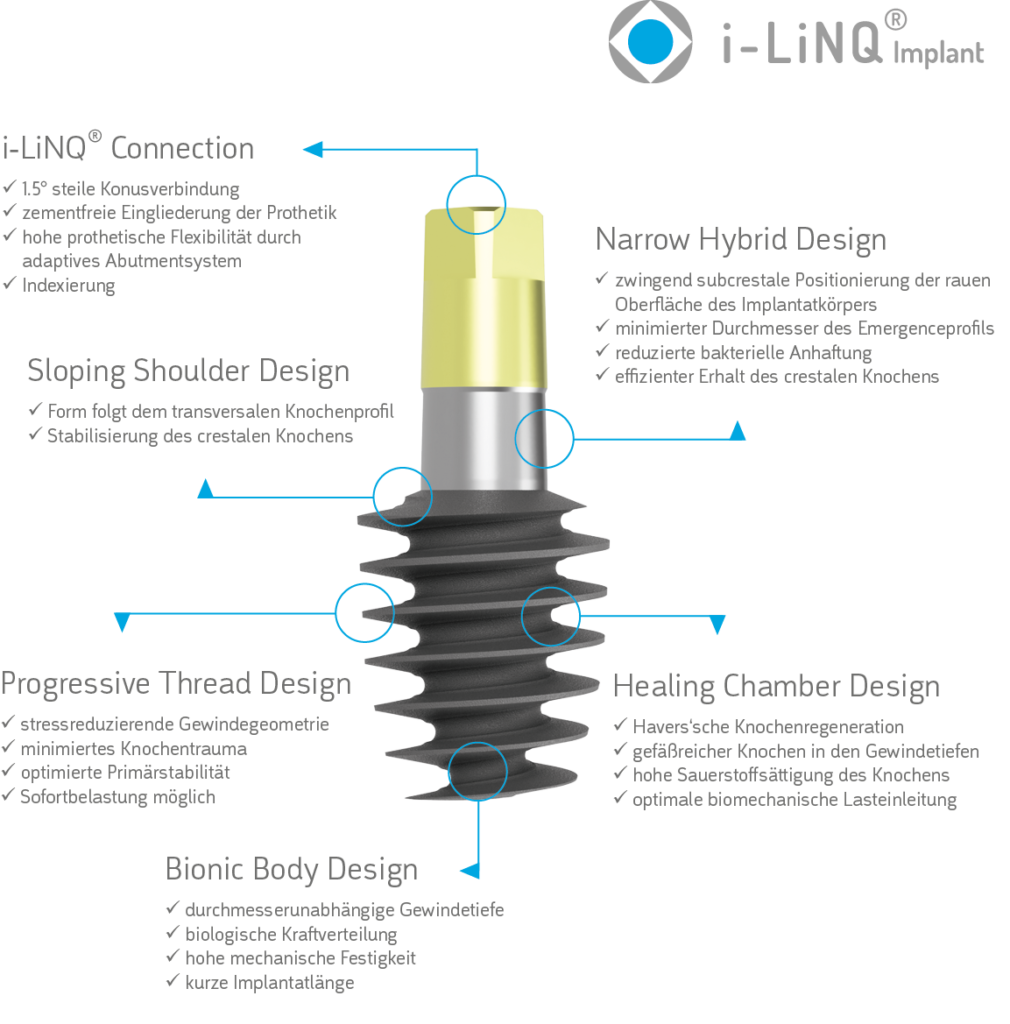 i-LiNQ®Implant › ImplantConcept