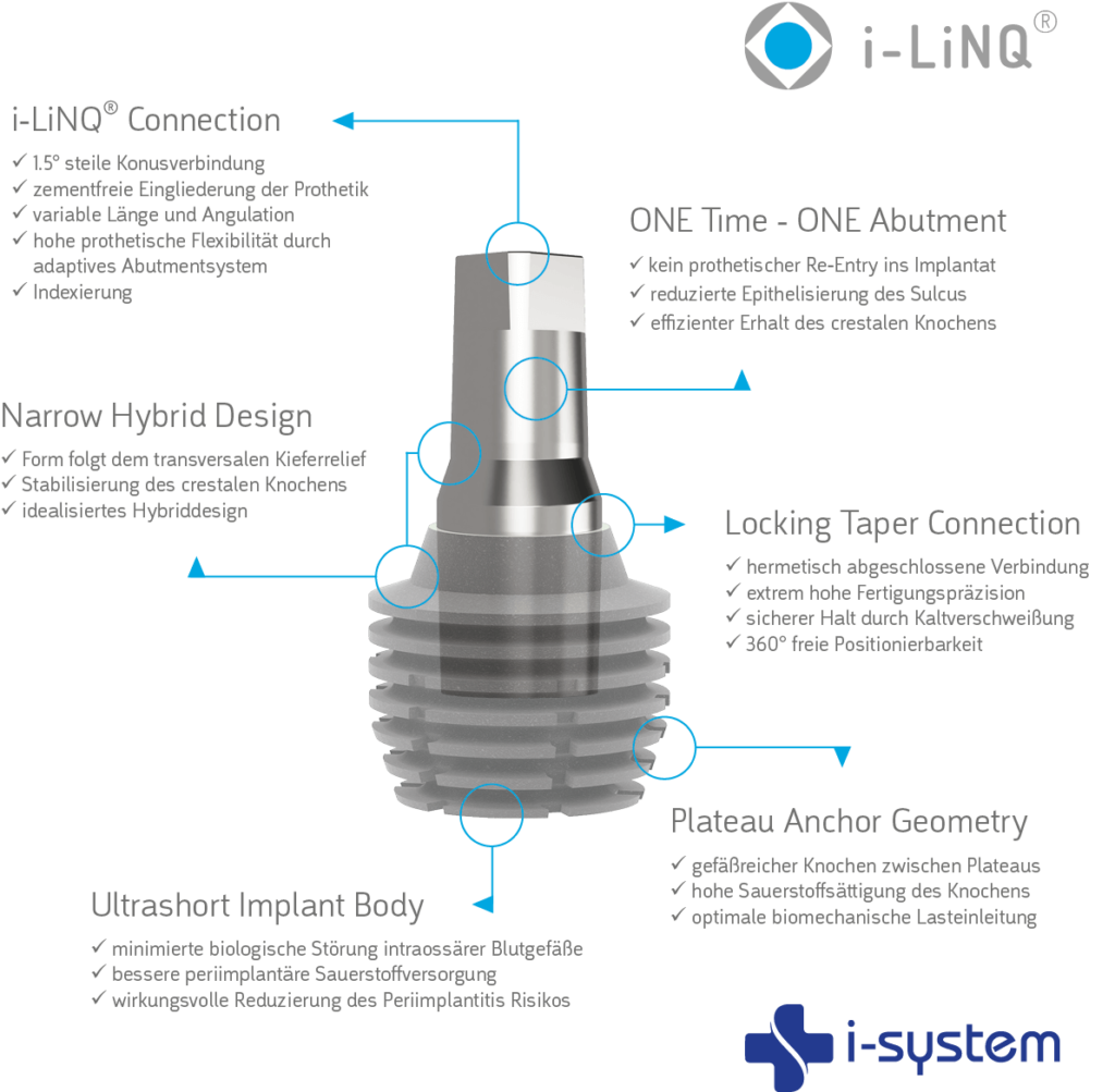 i-LiNQ® › ImplantConcept