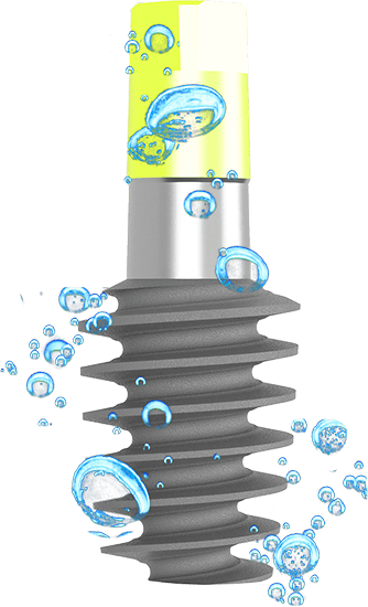 i-LiNQ®Implant › ImplantConcept